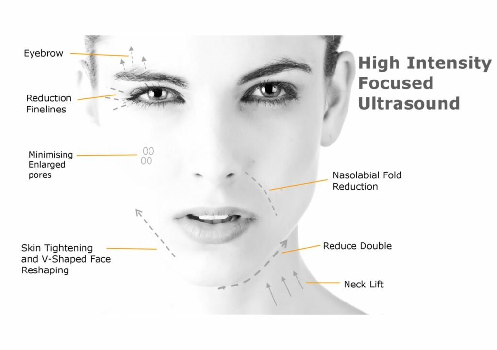 HiFU - Deep Tissue Collagen Induction Technique - Praxis am Kärntner Ring 6
